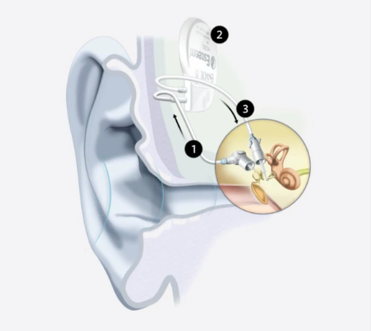 Battery Depletion what to Expect